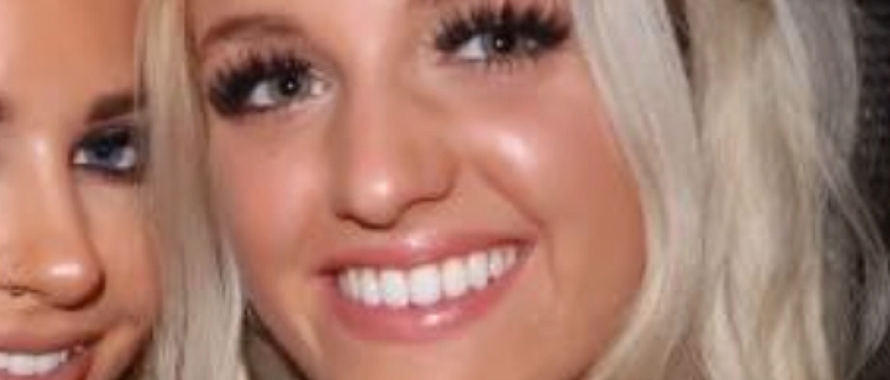 Is a natural smile about to be a new trend? - Traceybell Liverpool ...